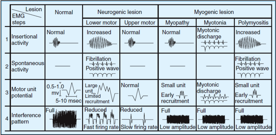 Insertional activity